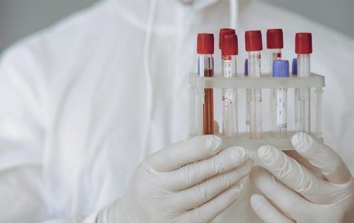 What’s-the-Right-Temperature-for-Transporting-Samples – Bioevopeak